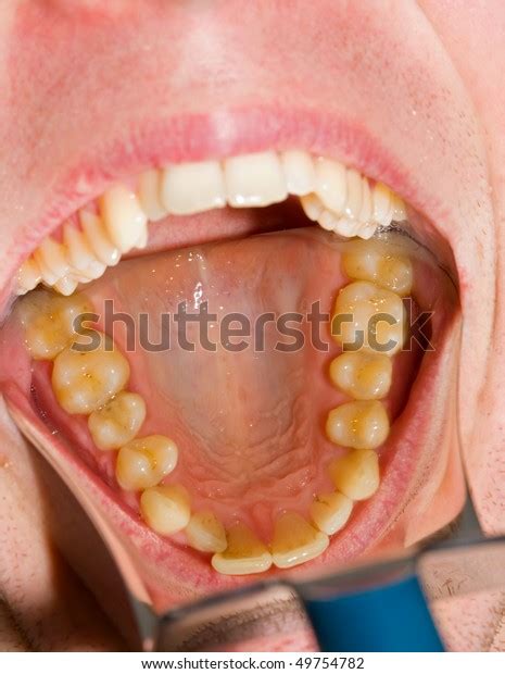 13 Resultados De Imágenes Fotos De Stock E Ilustraciones Libres De