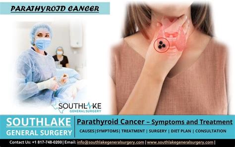 Parathyroid Cancer Symptoms And Treatment Artofit