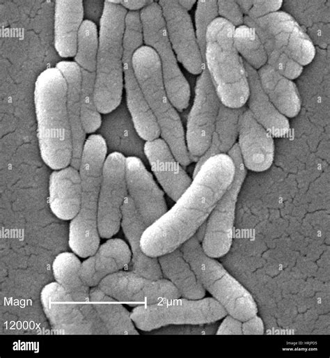 Salmonella Typhimurium Electron Micrograph
