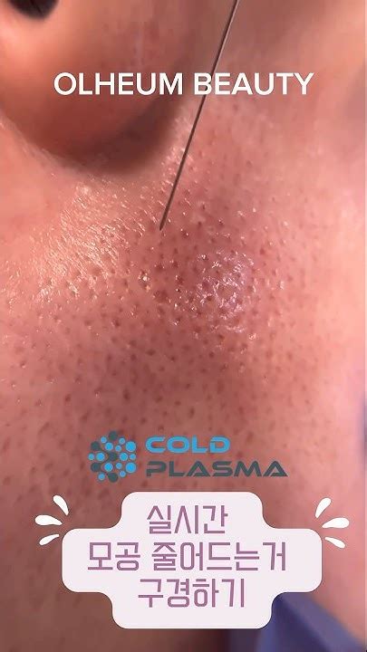 플라즈마 피부관리 창업 교육 동작구 플라즈마시술 플라즈마교육 1인창업⚡️실시간 나비존 모공 줄어드는 마법 🎀옳음 뷰티 01082934711 Shorts 모공 나비존