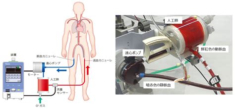 人工肺 日本人工臓器学会