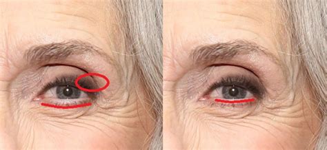 უფროსი ასაკის ქალბატონებო რატომ უსვამთ ხაზს თვალების დაბინდულობას