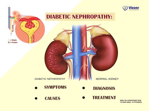 Diabetic Nephropathy Symptoms Diagnosis Causes And Treatment