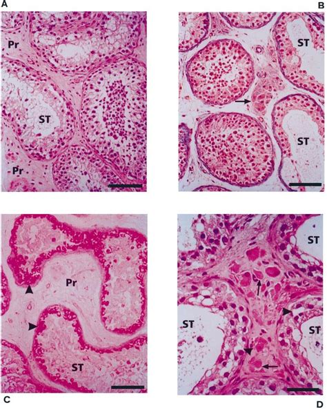 A B Seminiferous Tubules Are Dilated And Hypocellular With Arrested