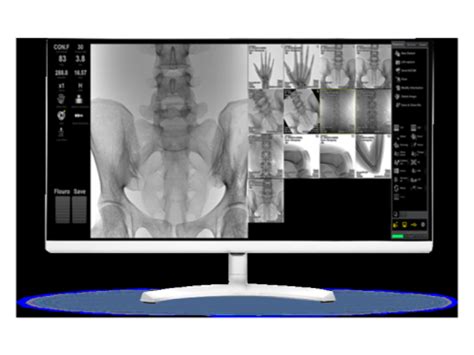 C Arm With FPD Platinum Health Care