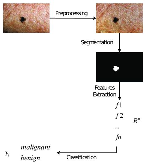 Skin Cancer Detection Using Matlab Image Processing P