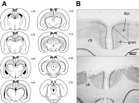 Dysgranular Retrosplenial Cortex Lesions In Rats Disrupt Cross Modal