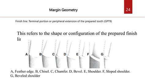 Principles Of Tooth Preparationpptx