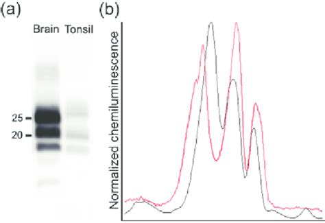 Different Prp Res Profiling In Brain And Tonsil Homogenates A Download Scientific Diagram