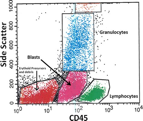Flow Cytometry Results Of Bone Marrow Aspirate Obtained At Diagnosis