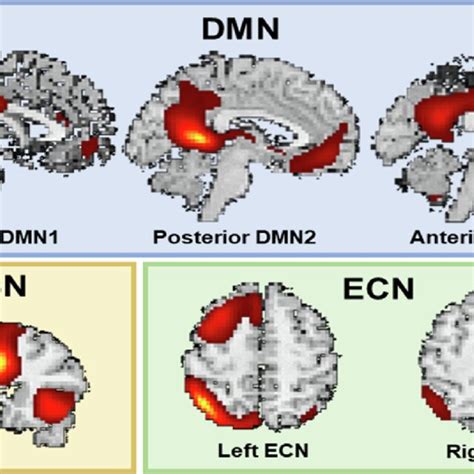 Resting State Brain Networks Identified By The Independent Component