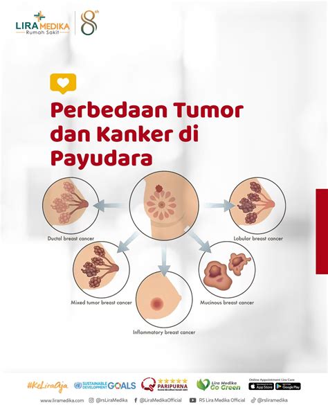 Perbedaan Tumor Dan Kanker Di Payudara