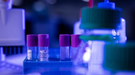 These Are Ivd Products Future Diagnostics