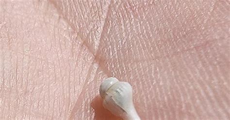Tiny Little Whelk Shell From A Washed Up Egg Casing Album On Imgur