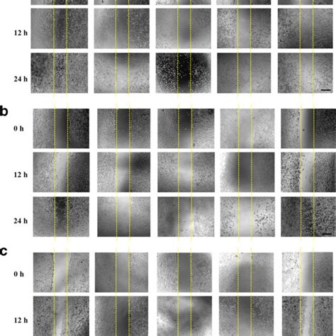 Effects Of Shikonin Deoxyshikonin And ββ Dimethylacrylshikonin On Download Scientific