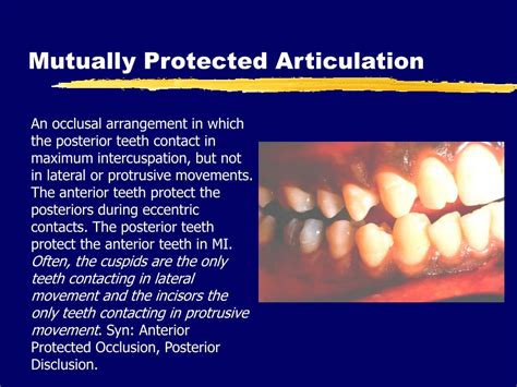 Ppt Fsbgd Occlusion Review Powerpoint Presentation Free Download Id 4145041