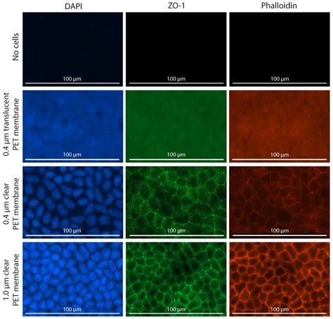 Cellular Fluorescence Imaging With Millicell® Cell Culture Inserts