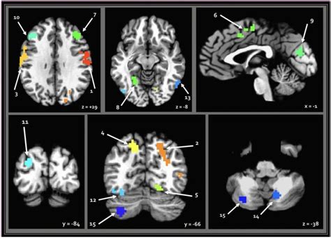 Sex Differences In Resting State Functional Connectivity Of The Cerebellum In Autism Spectrum