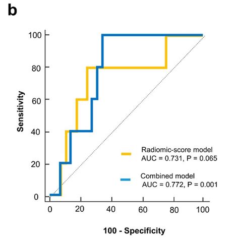 Roc Curves Of Radiomic And Combined Models A Training Cohort B