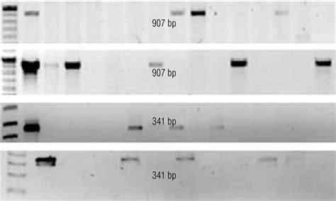 Pcr Identification Of Transformed Plants Pcr Product From Plants