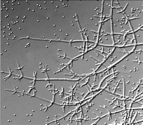 Investigadores Del Ciale Y Agrienvironment Revisan Las Funciones Del Hongo ‘trichoderma En
