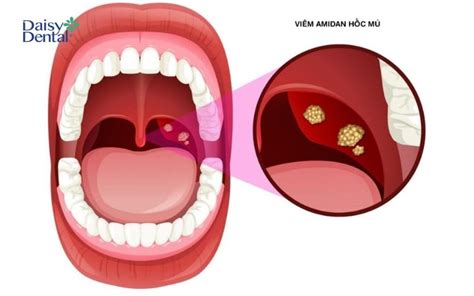 H Nh Nh Vi M H Ng H T Ph Bi N Nh N Bi T S M B Nh L