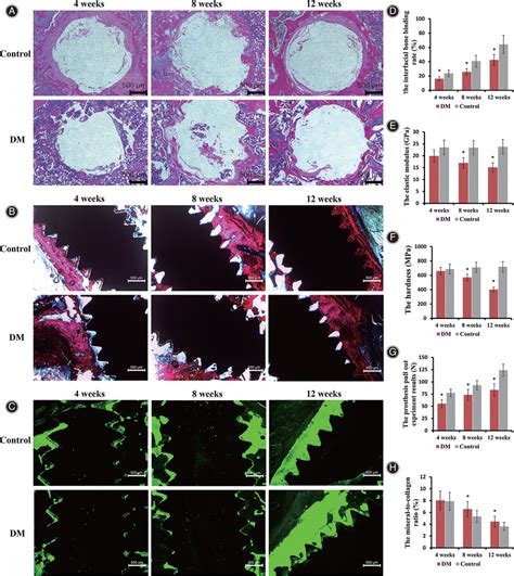 Histological And Histomorphometric Analysis Micro‐indentation