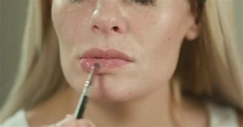 Distinguishing Between Chapped Lips And Cold Sores