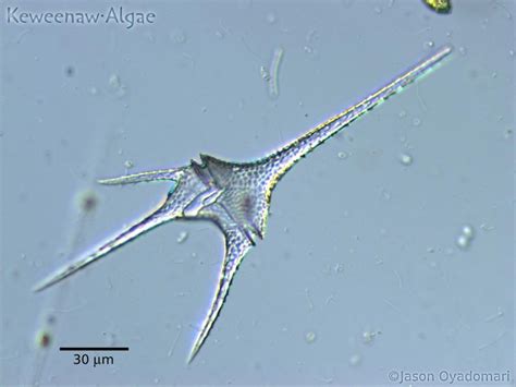 Dinoflagellates Under Microscope Labeled