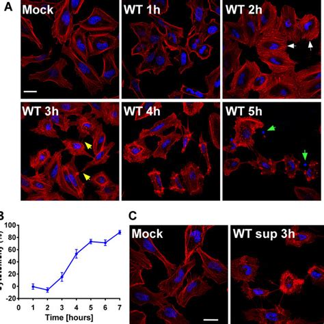 V Proteolyticus Induces Cytoskeletal Rearrangements Followed By Lysis
