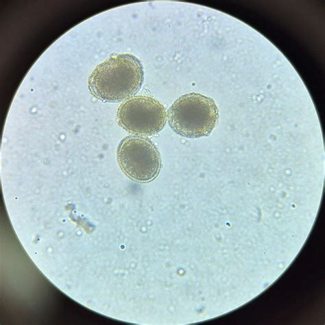 Scarlett Castro On Linkedin ~parasitology Toxocara Spp Eggs Found In