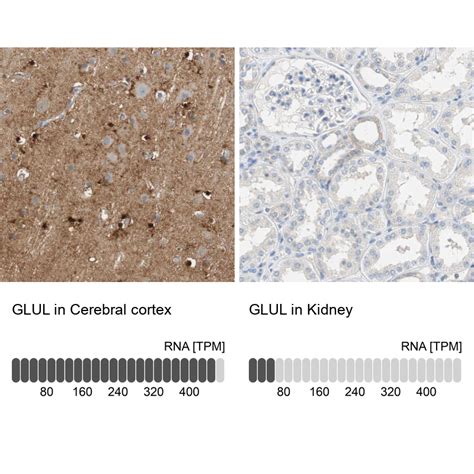 Rabbit Polyclonal Anti Glul Antibody Buy For Research Highly