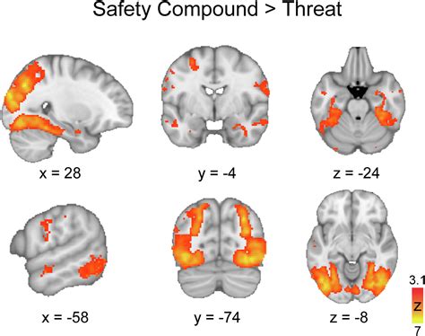 Hippocampal Involvement In Safety Signal Learning Varies With Anxiety