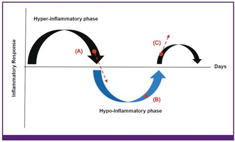 Inflammatory Response To Sepsis Immune Response To Sepsis Is Both