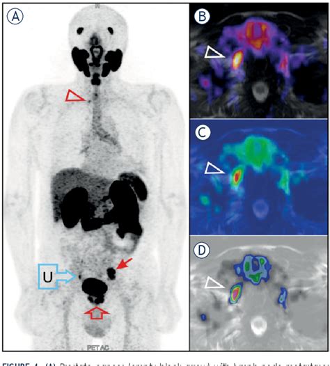 Figure 4 From The “question Mark” Mr Anatomy Of The Cervico Thoracic