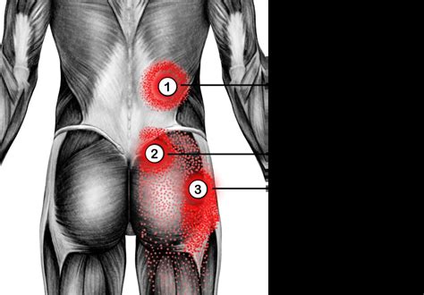 Back And Glutes Trigger Points The Tides BrainBodyMind Wellness