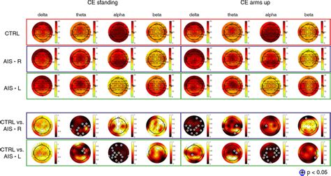 Topographic Maps Of Relative Power In Delta 14 Hz Theta Download Scientific Diagram