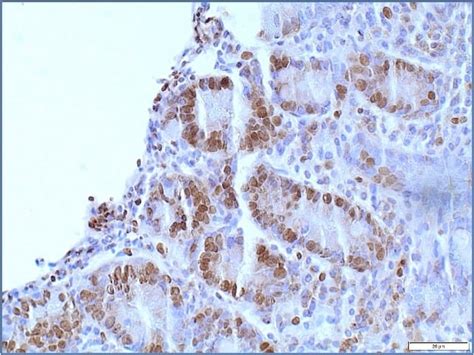 Villin 1 Human Mab Clone 9h11