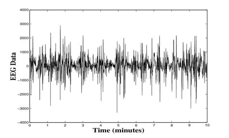 Ten Minute Eeg Time Series Data Download Scientific Diagram