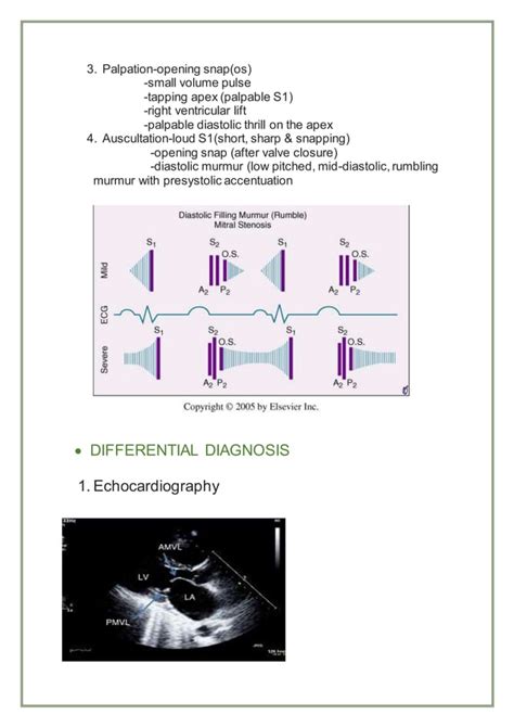 Mitral Stenosis Propeduetics Pdf