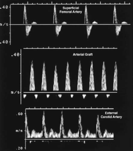 Vascular Ultrasound Radiology Key