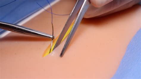 Subcuticular Suture Osce Guide Surgical Skills Geeky Medics