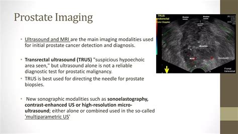 Carcinoma Of Prostate And Its Management Pptx