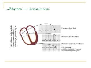Powerpoint Presentation Of Ecg Quick Referenceppt