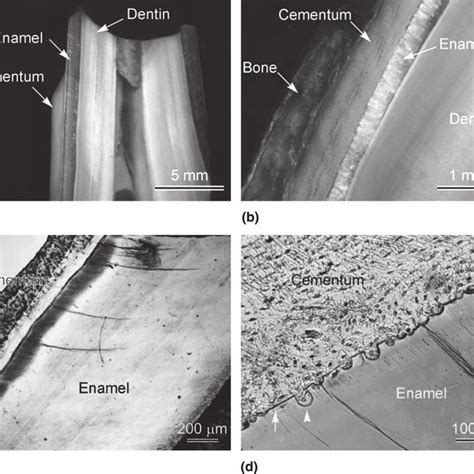 Pdf Microstructure And Interfacial Fracture At The Cementum Enamel