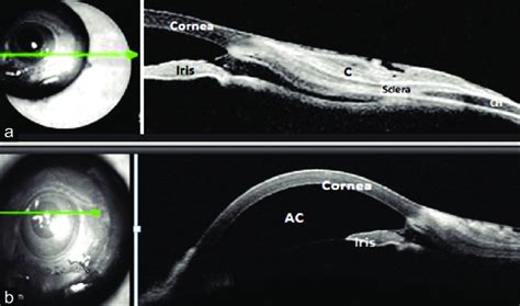Representative Cross Sectional Spectral Domain Optical Coherence Download Scientific Diagram