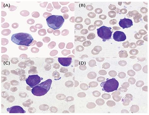 Journal Of Clinical Images And Medical Case Reports