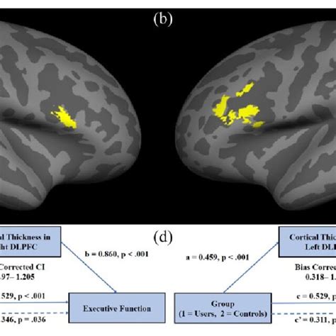 The Right A And Left B Dorsolateral Prefrontal Cortex Dlpfc The Right A And Left B Dorsolateral Prefrontal Cortex Dlpfc