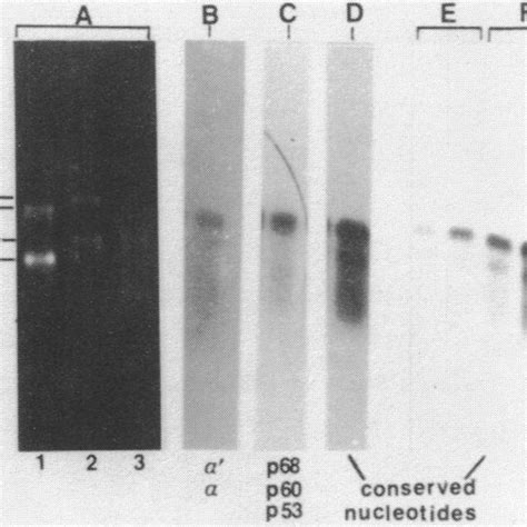 Dot Matrix Comparison Of The Cloned Soybean Cdnas For The A Subunit Download Scientific