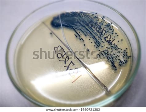 Growing Bacteria In Agar Medium In Microbiology Lab Micro Organisms Enterobacter Grow Urine